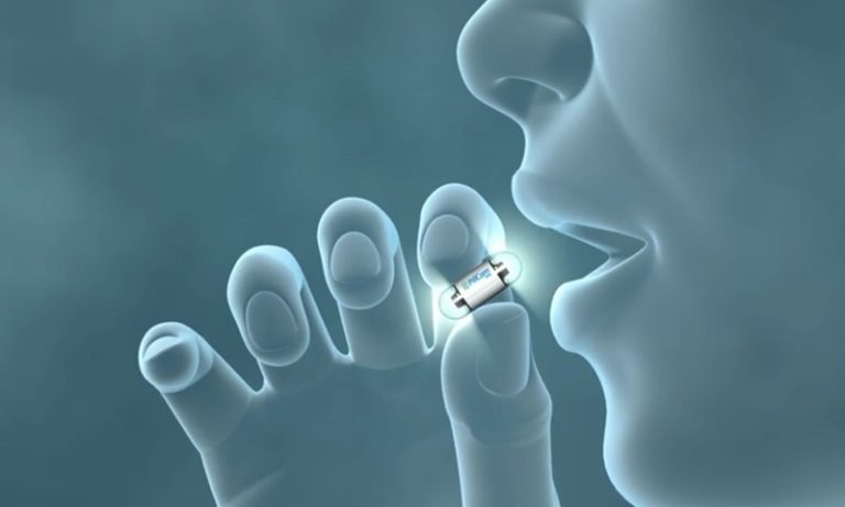 Colon capsule endoscopy (CCE) | NHS inform