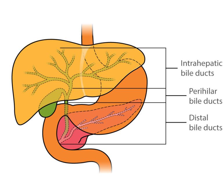 Bile duct cancer | NHS inform