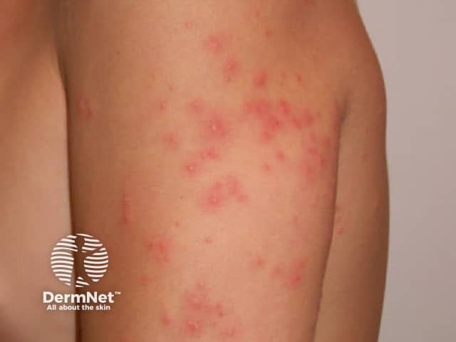 Risks of open water swimming in Scotland | NHS inform